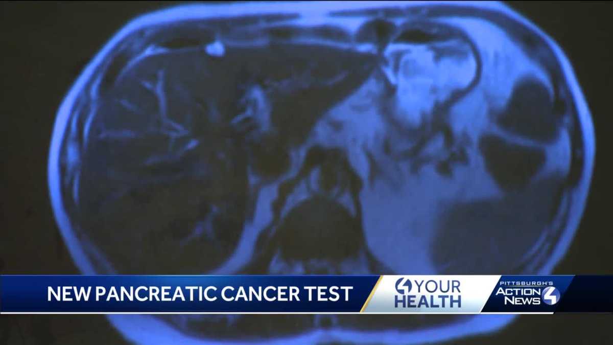 New test could help with early detection of pancreatic cancer