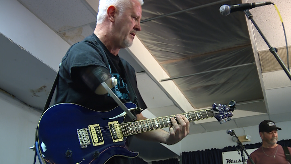 'Like I've never lost anything': Middletown guitarist gets prosthetic ...