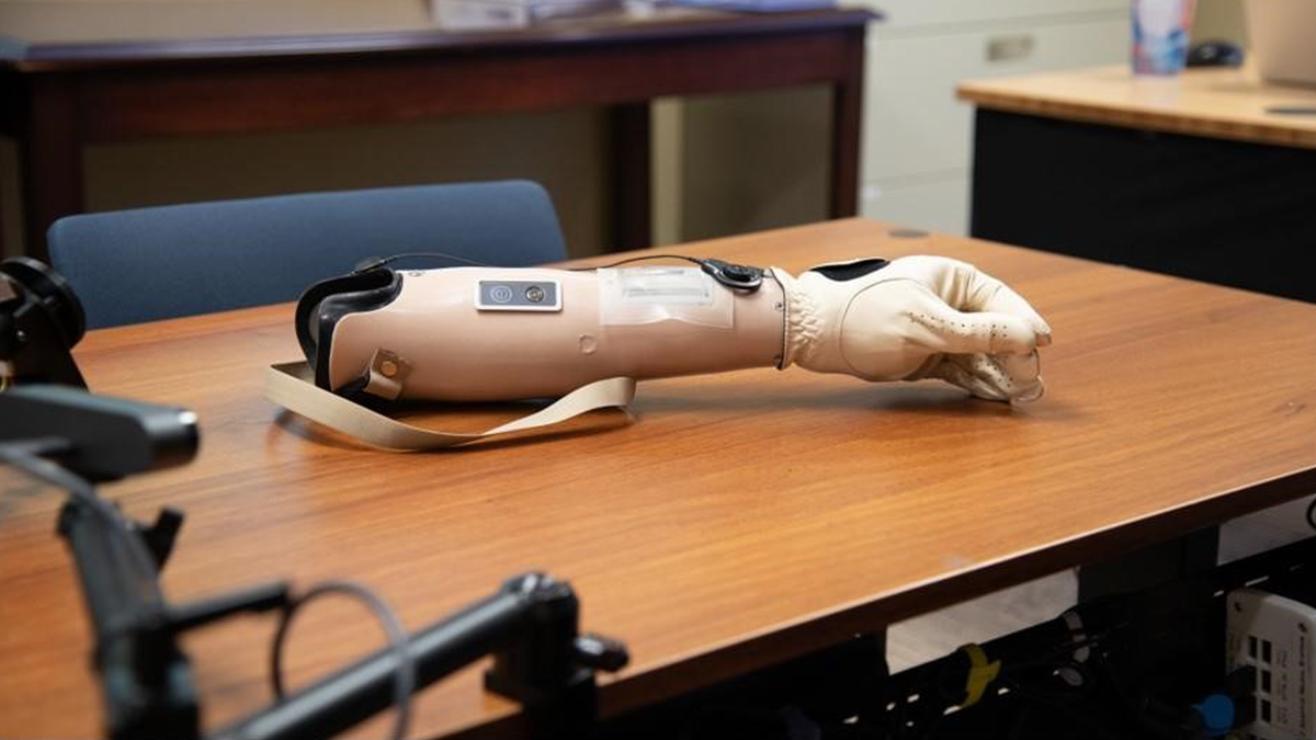 University of Arkansas develops new prosthetic hand tech
