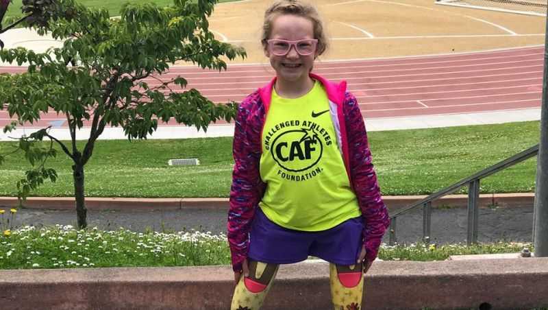 9-year-old given new legs after wildfires claim prosthetics