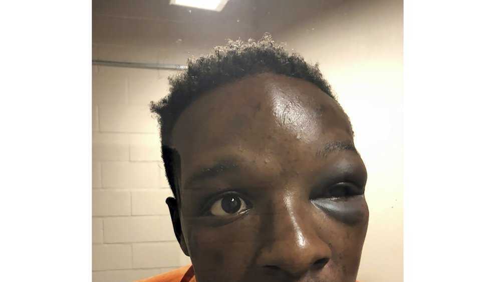 Sheriff: Georgia deputy caught on video repeatedly punching Black man ...