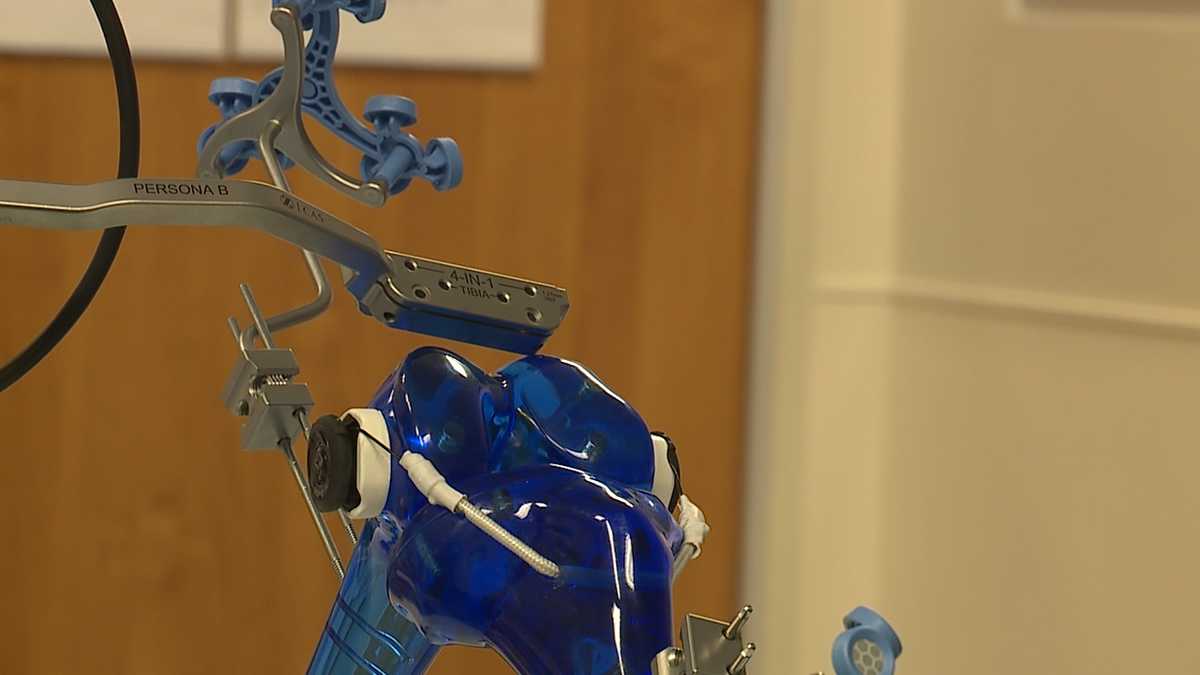 Memorial using first in the state machine for knee replacement