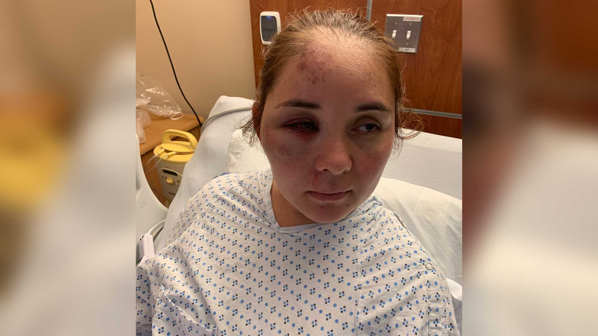 Mom Beaten And Knocked Unconscious By Son s 13 year old Bully Family Says mom-beaten-and-knocked-unconscious-by-son-s-13-year-old-bully-family-says