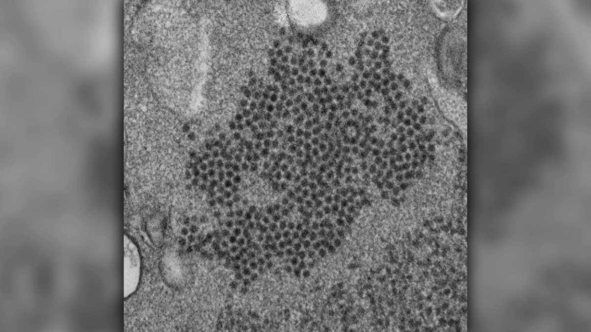 CDC: 2 dozen more cases of rare 'polio-like' illness confirmed