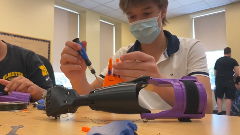 'It makes me happy': 7-year-old getting new prosthetic hand, thanks to ...
