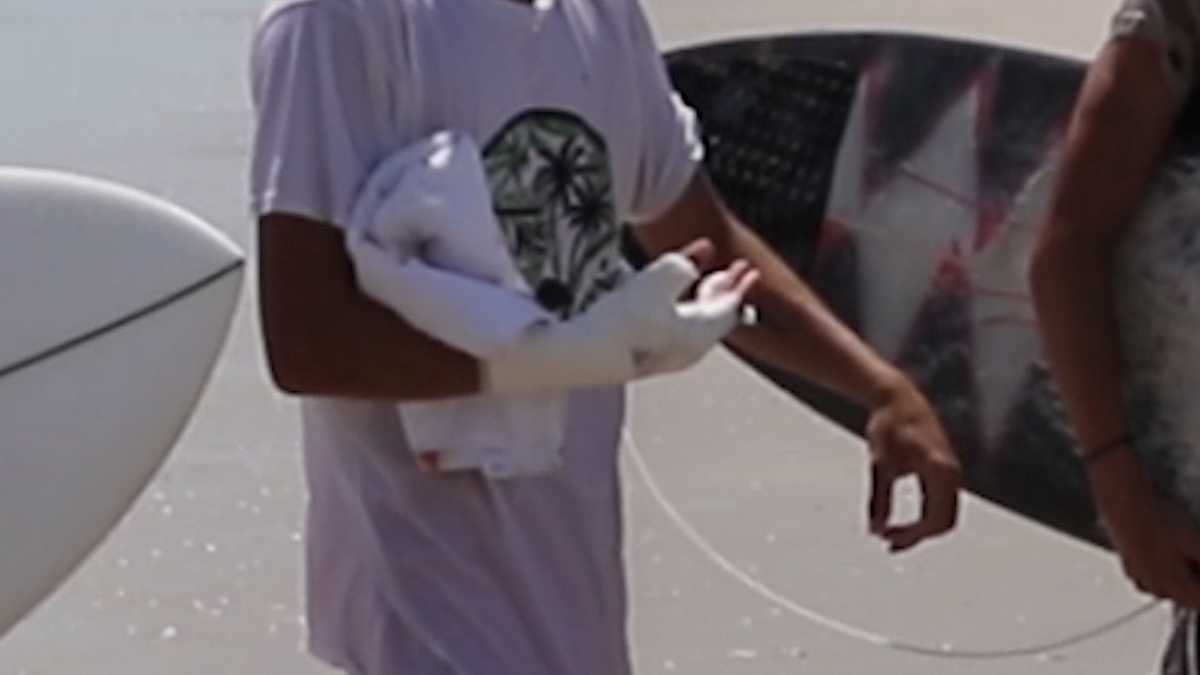 Shark bites teen surfer in New Smyrna Beach