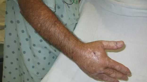 SC man bitten by snake when he reaches in toolbox: 'It could have been ...