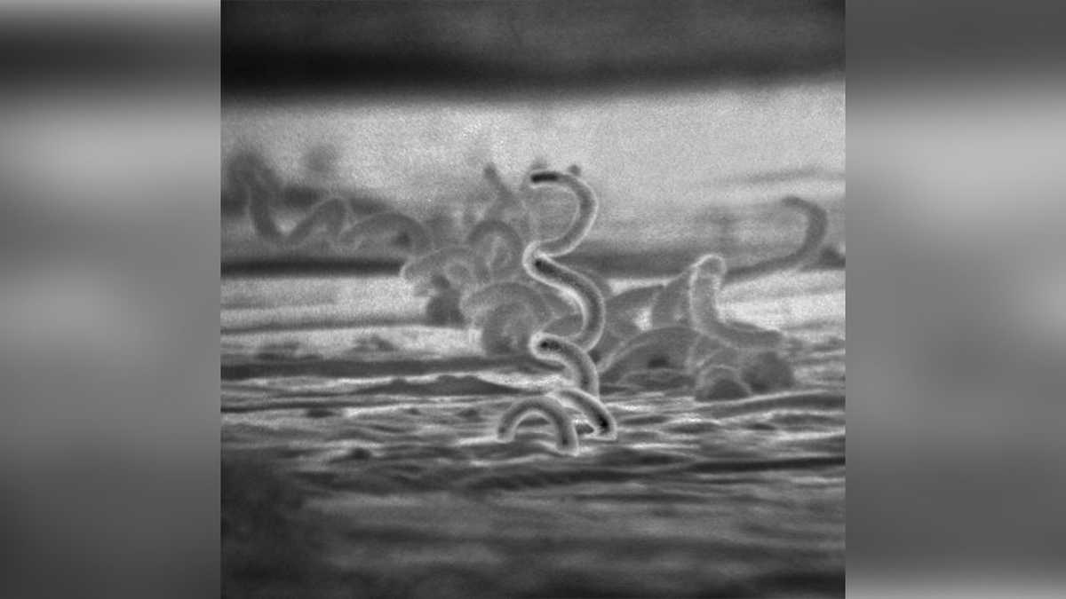 Health officials warn of syphilis outbreak in New Hampshire