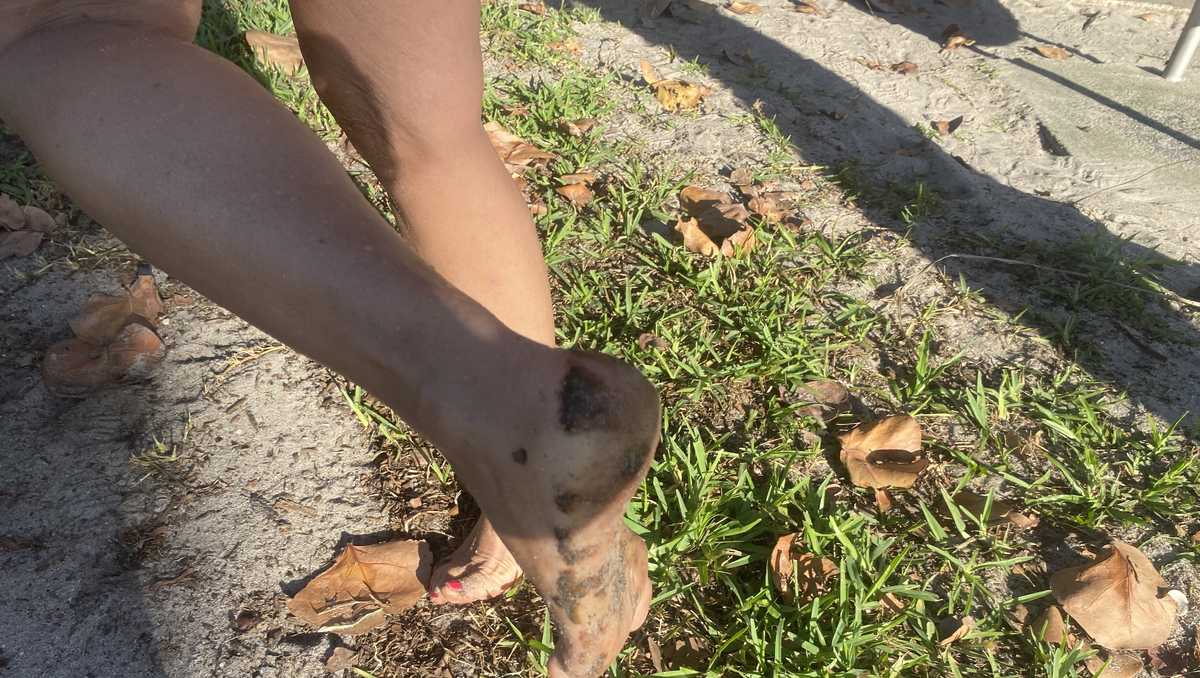 'I thought it was a piece of algae': Lake Worth Beach swimmers report ...