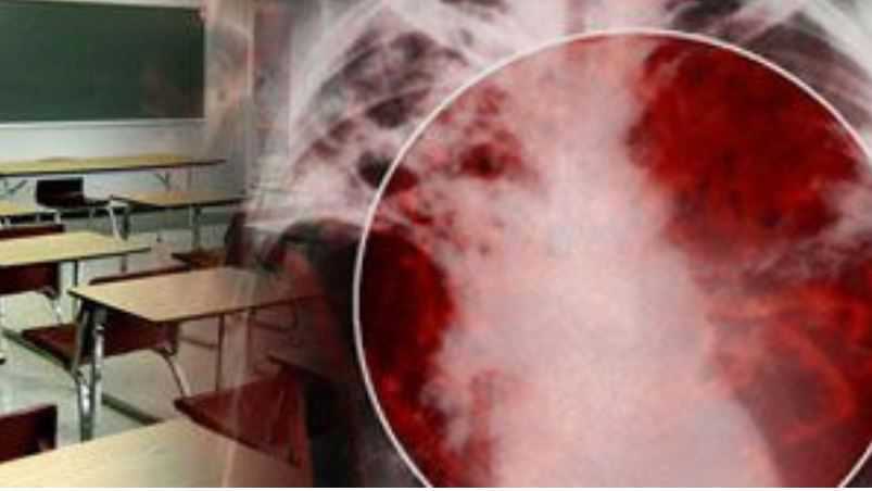 DHEC investigating TB case at Upstate high school