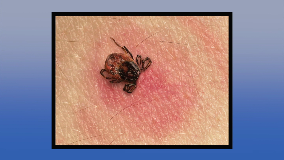 I found a TICK! Now what?