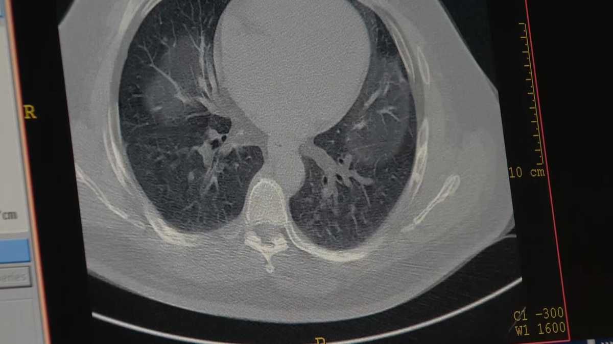 Woman's Doctor: Scanning for signs of heart attack