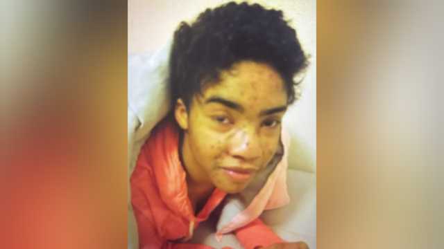 Critically missing teen: Milwaukee police say 14-year-old girl has been ...