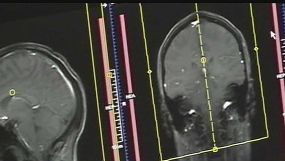 Here's how you can identify concussions