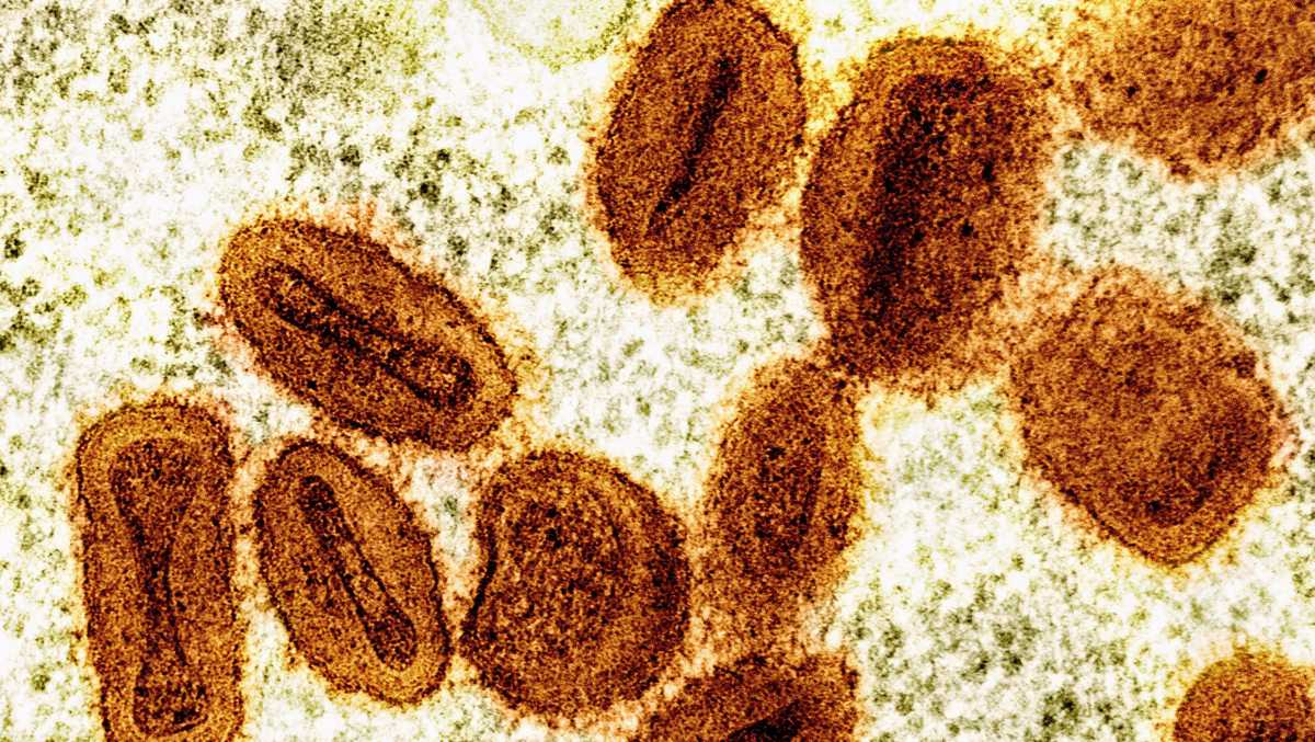 2 scientists charged in mpox smuggling case