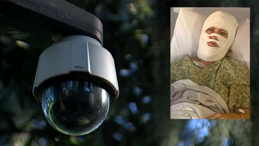 New security cameras installed at Forsyth Park after acid attack - WJCL