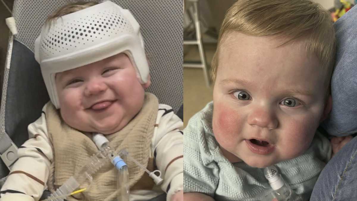 Baby born at 24 weeks heading home after 400 days in the NICU