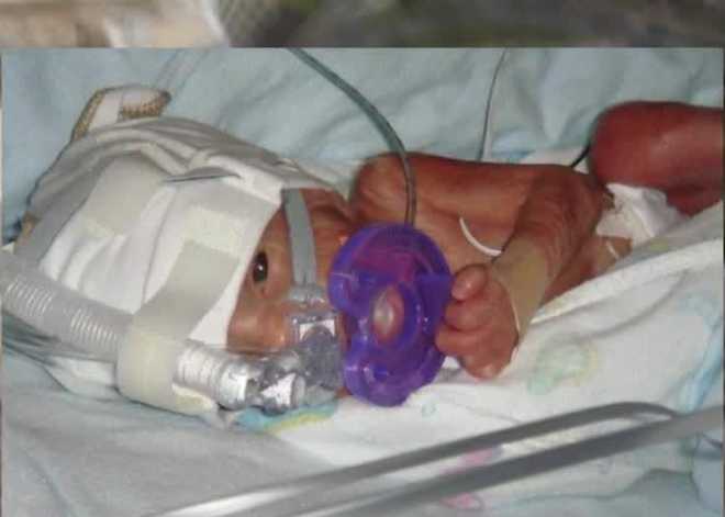Miracle child Mitchell Pollock graduates high school after overcoming ...