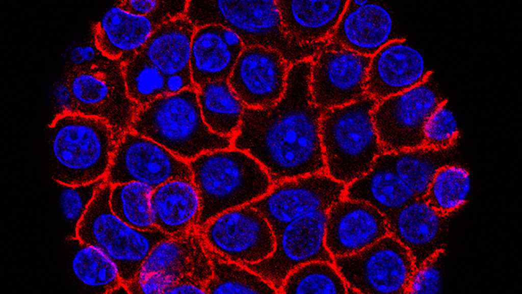 Experimental pill promises new hope for deadly pancreatic cancer