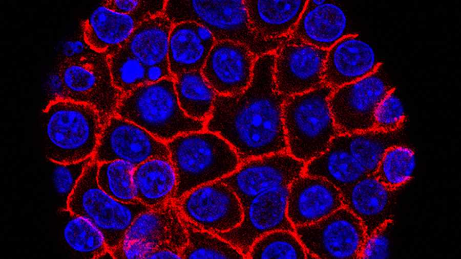 Experimental pill promises new hope for deadly pancreatic cancer