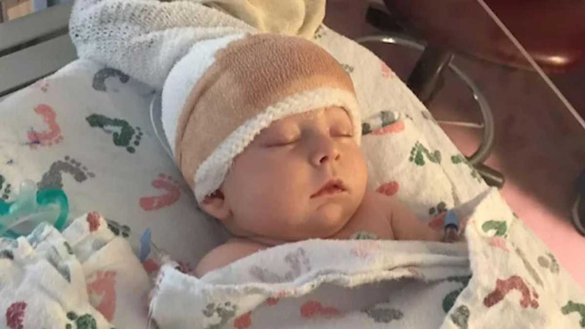 7-week-old girl hospitalized with brain bleed after being hit by ...