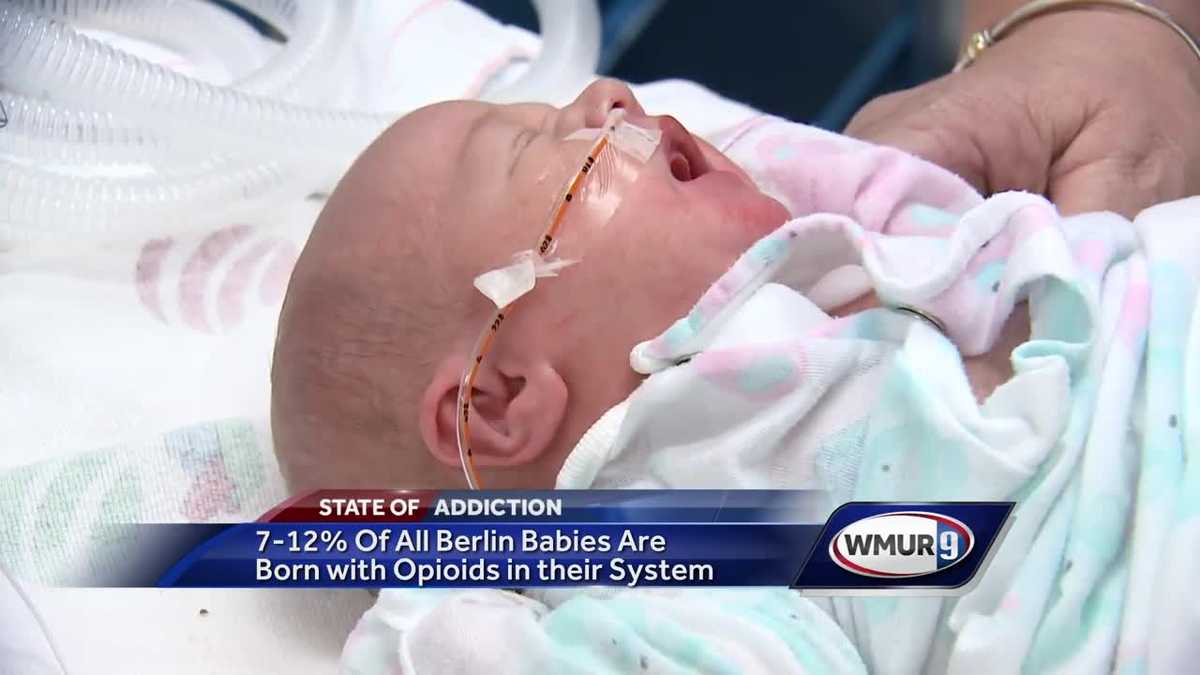 Number of babies born with neonatal abstinence syndrome is on rise