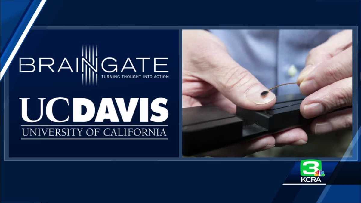 UC Davis recruiting people for clinical trial aiming to restore speech