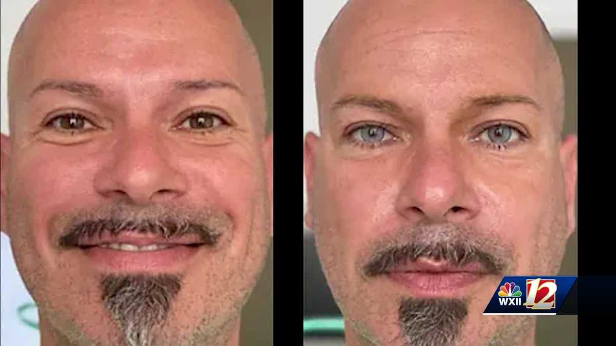 North Carolina: Surgeons promote permanent eye-color-change surgery