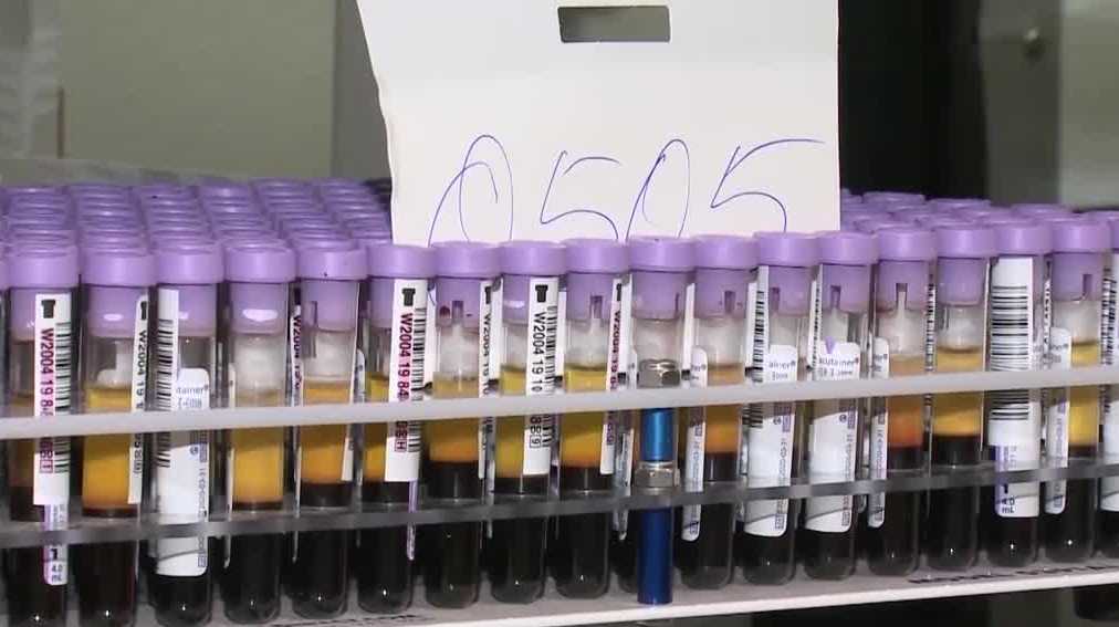 Lab tests blood samples to ensure patients get right type of blood