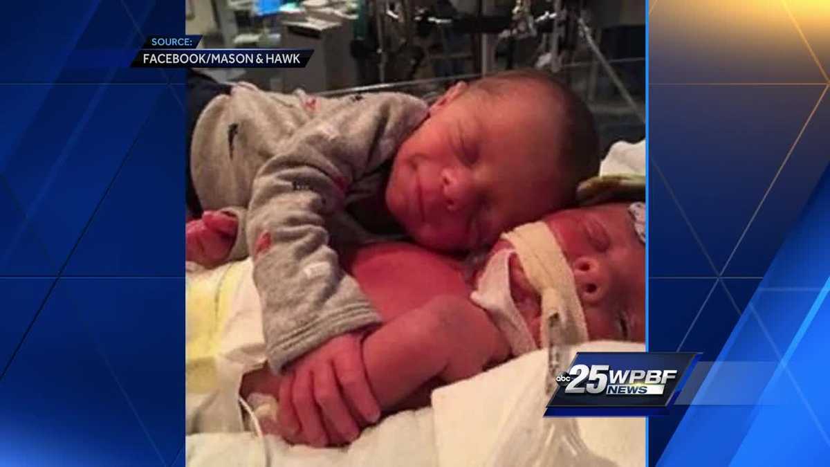 Twin Dies After Photo Goes Viral