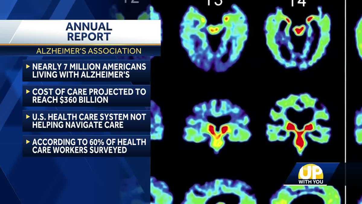 2024 Alzheimer’s Association report on new findings