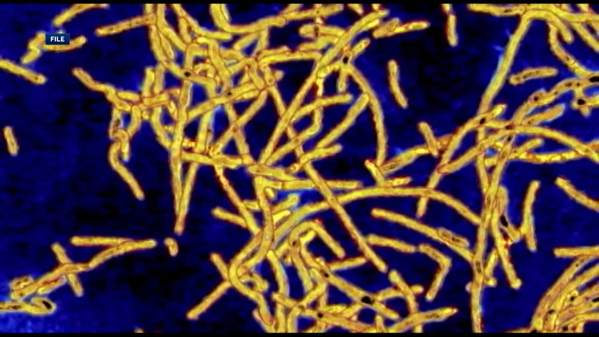 Legionella pathogen found in CVPH water system