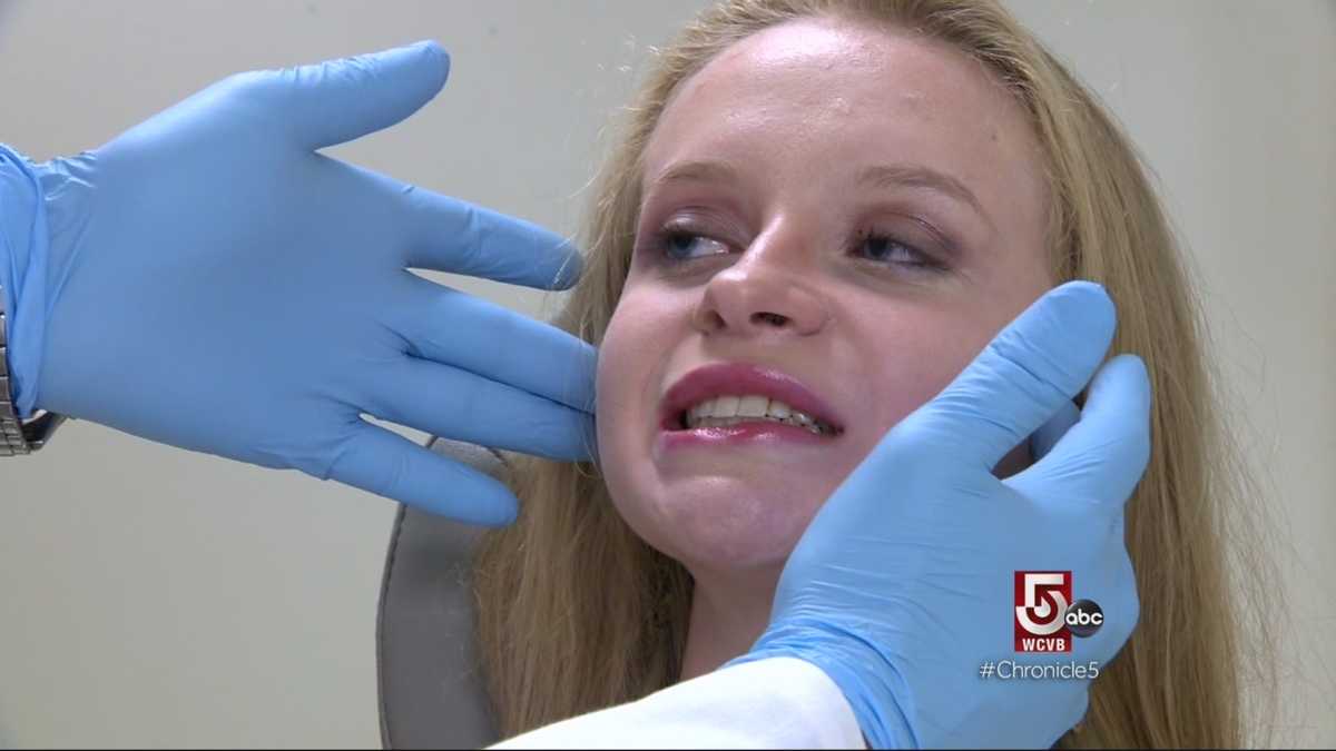 Botched French Surgery Fixed in Boston