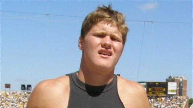 Man burned using backyard grill