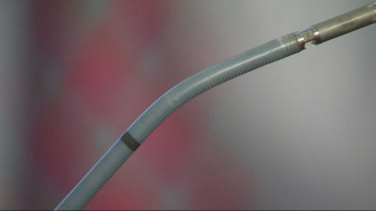 Tiny heart pump saving thousands of lives