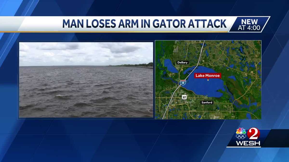 Alligator attack: Florida man bit while swimming in Seminole County lake