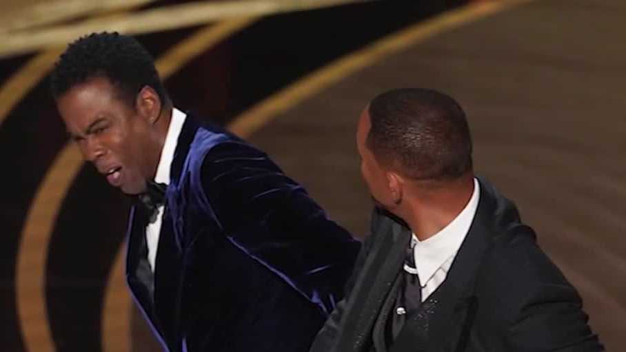 Will Smith's Oscars slap raising awareness for alopecia