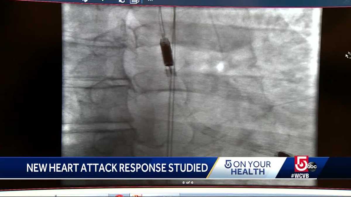 Delaying treatment better after heart attack?