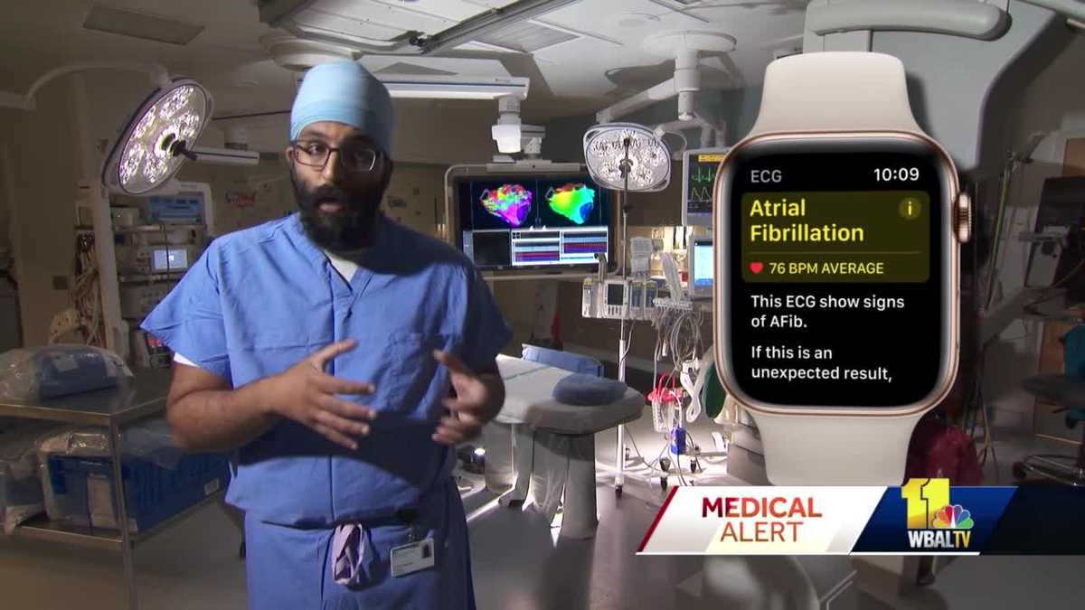 How smartwatch technology could monitor for atrial fibrillation