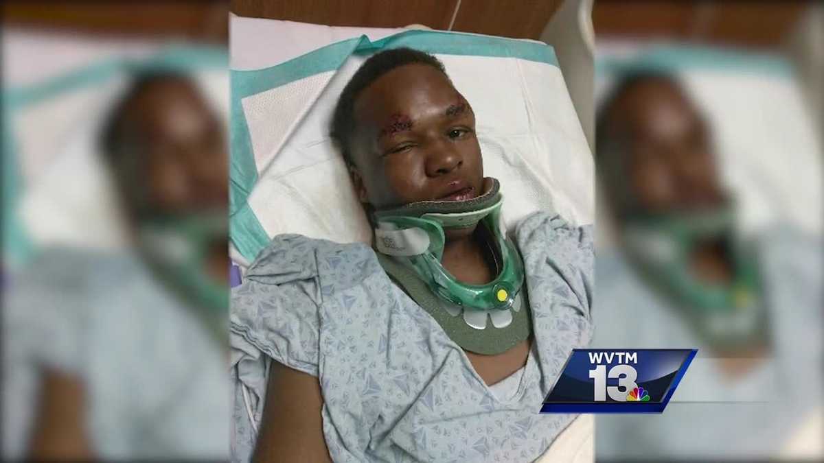 Hit And Run Victim Released From Hospital