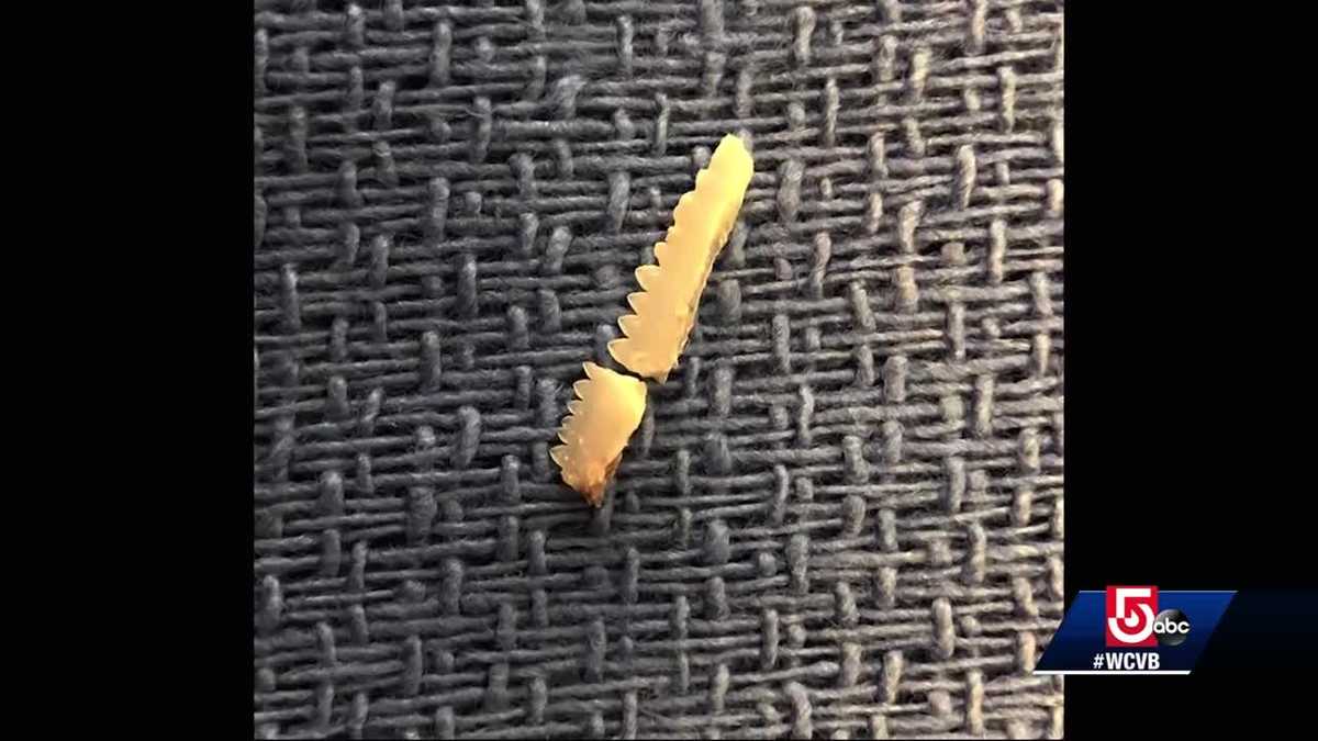 Tooth removed from Cape Cod shark attack victim