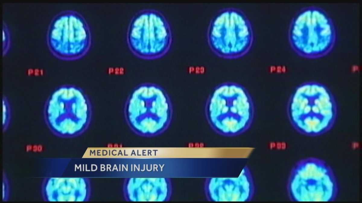 Medical Alert- Mild Brain Injury
