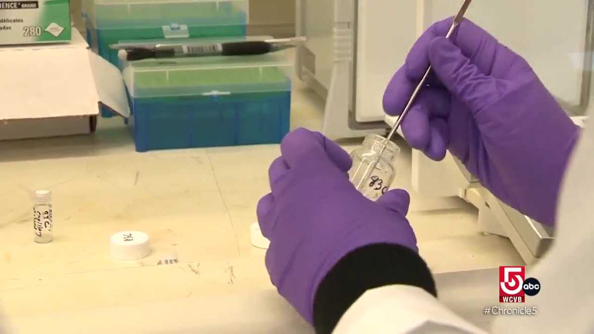 Mass. doctor leads new treatment offering hope to lupus patients