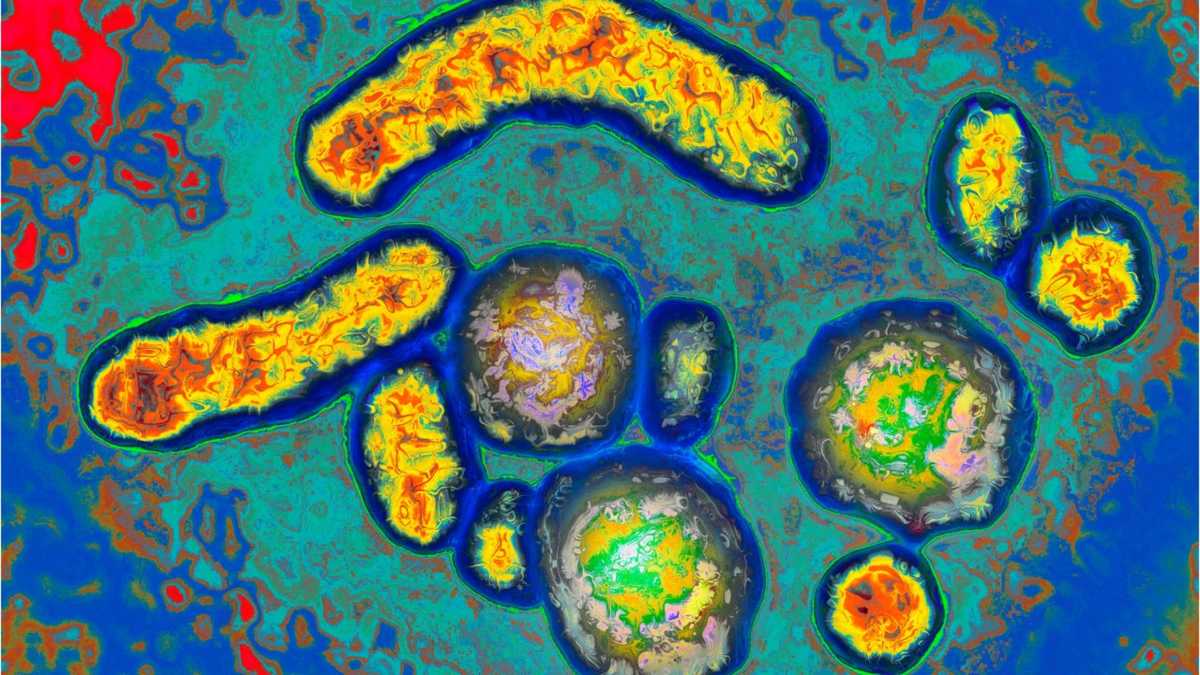 Report: Georgia, South Carolina among the worst states for STDs