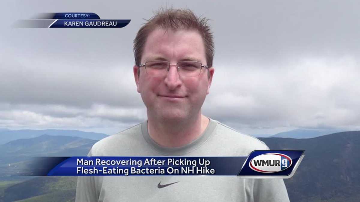 Man recovering from flesh-eating bacteria