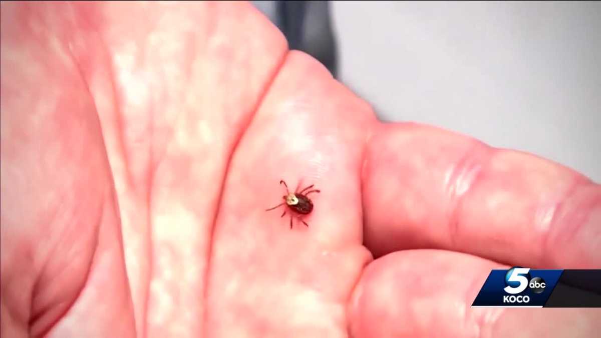 Experts advise Oklahomans about ticks, poison ivy
