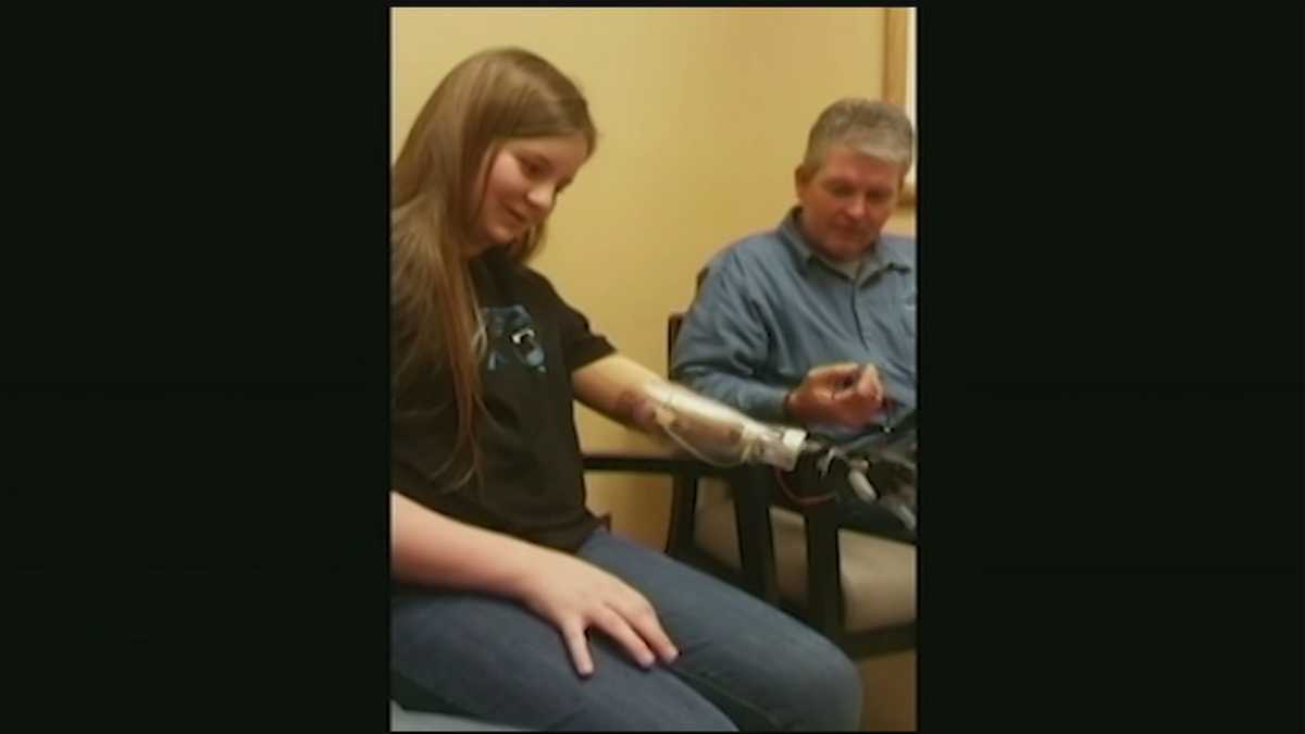 Shark attack victim gets new arm