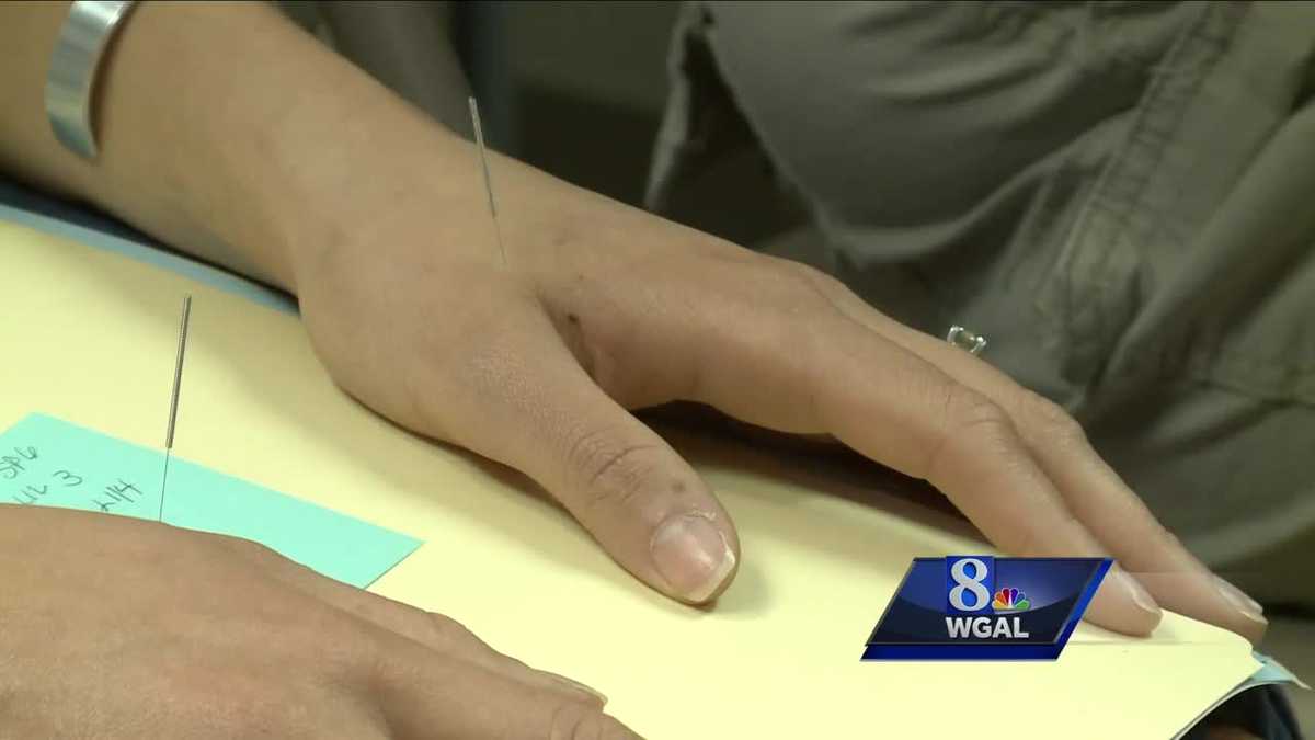 Patients tout benefits of "group acupuncture" to treat pain