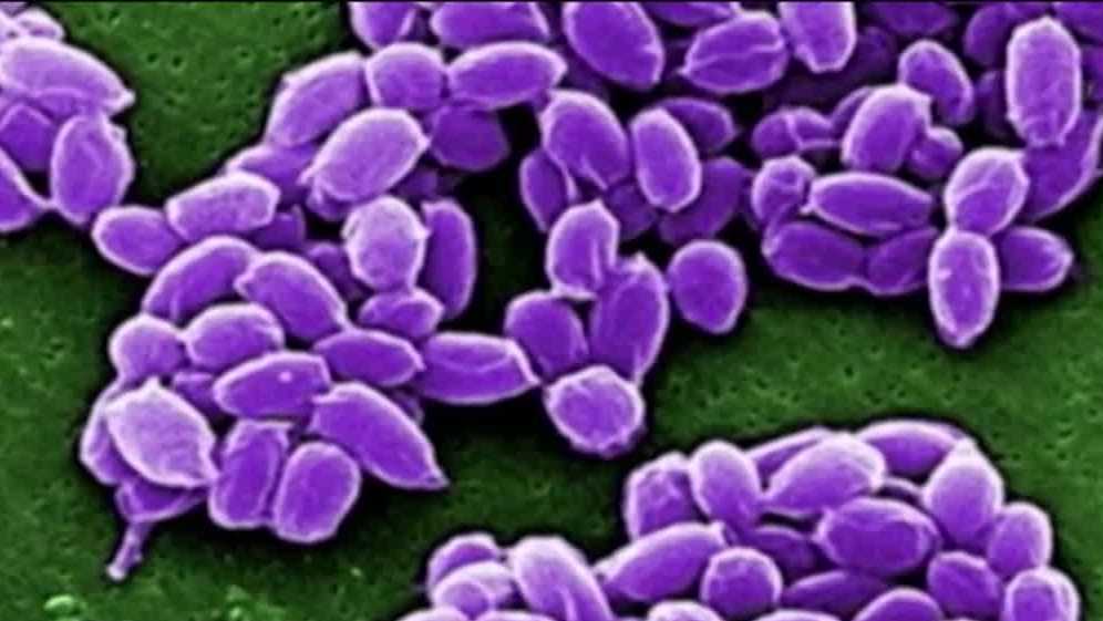Scientists express concern about Pitt COVID-19 vaccine research using ...