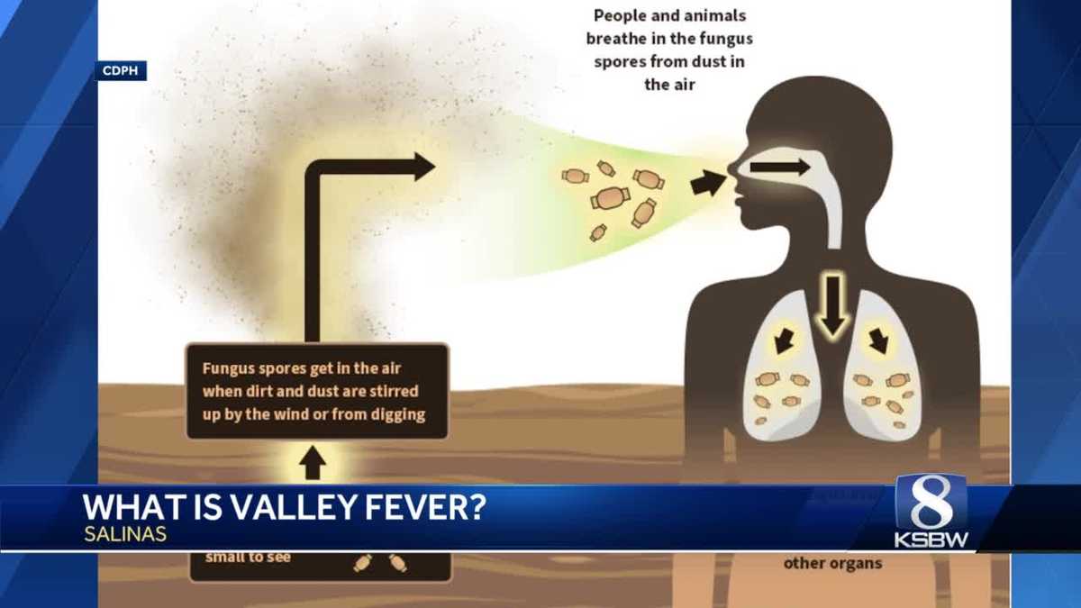 What is Valley Fever? Cases increasing on the Central Coast